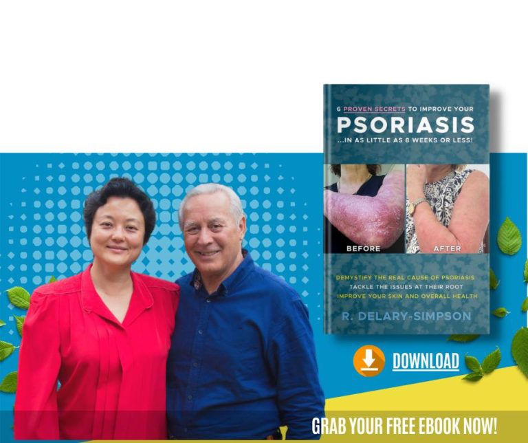 What is the Koebner phenomenon in Psoriasis? - Organic Health Solutions