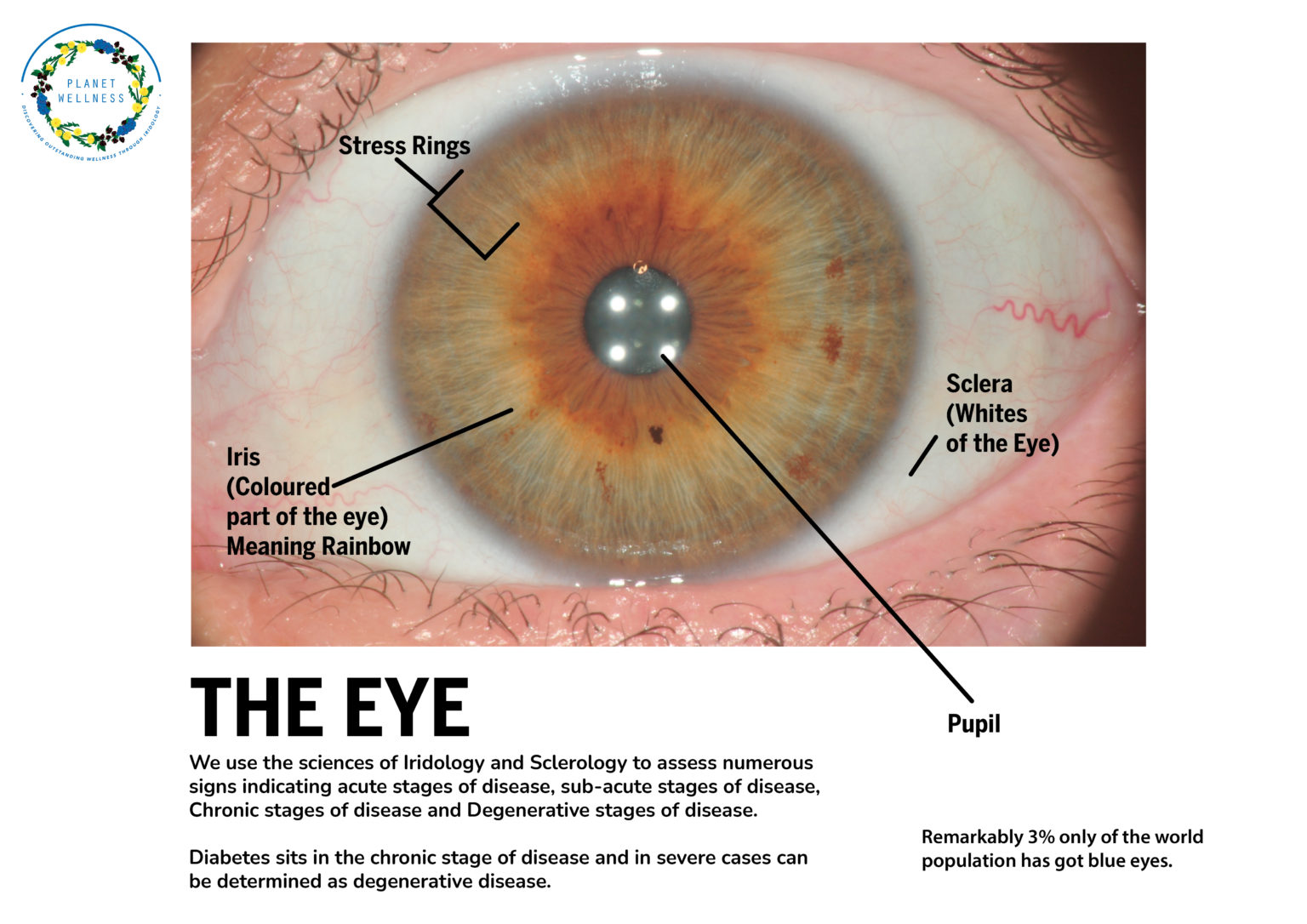 Iridology Pictures and Meanings - Organic Health Solutions