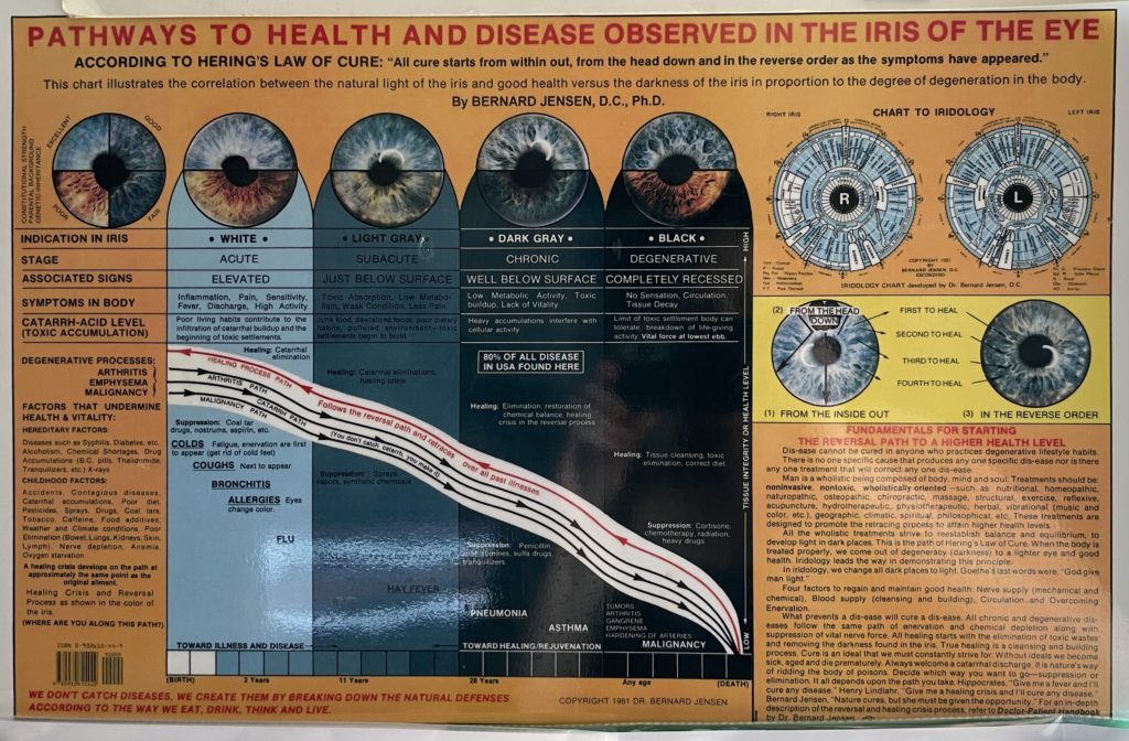 Can Iridology Detect A Brain Tumour? - Organic Health Solutions
