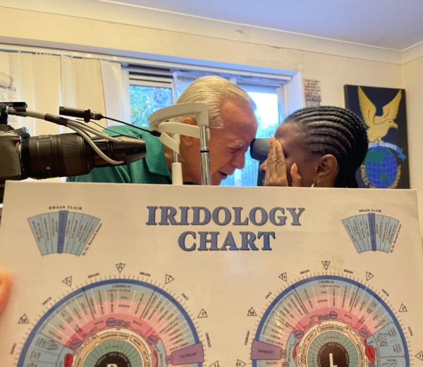 How To Get Rid Of Acne Using Iridology - Organic Health Solutions